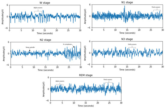 Machine-Learning-Based-Approaches for Sleep Stage Classification Utilising a Combination of ...