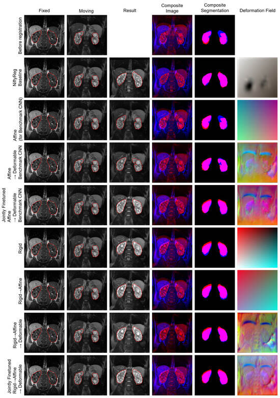 Applied Sciences | Free Full-Text | A Multistage Rigid-Affine-Deformable Network for Three ...