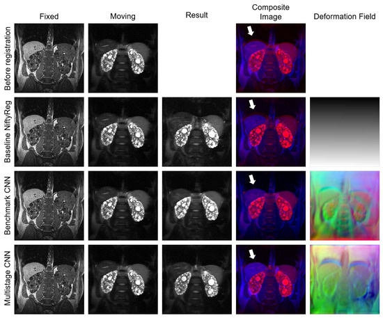 Applied Sciences | Free Full-Text | A Multistage Rigid-Affine-Deformable Network for Three ...