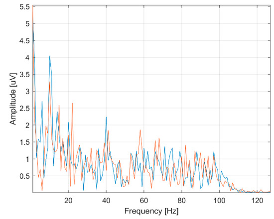 Applied Sciences | Free Full-Text | Convolutional Neural Network-Based Classification of Steady ...