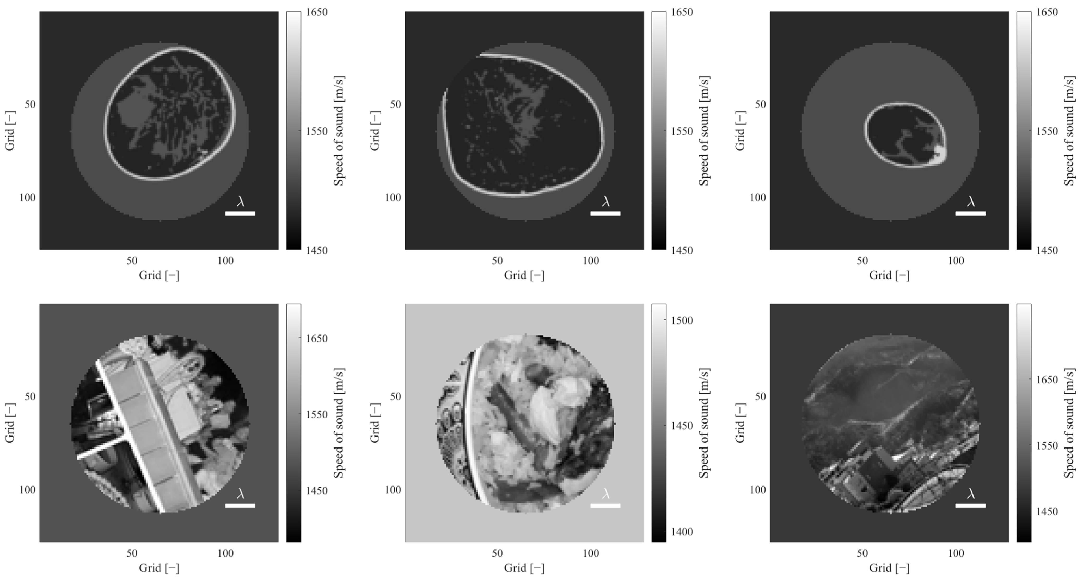 A Deep Neural Networks-Based Sound Speed Reconstruction with Enhanced ...