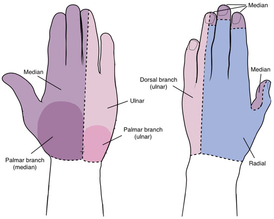 Hand Neuropathies and Musculoskeletal Disorders: Complementary ...