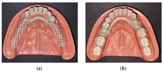 Fit Accuracy of Cobalt–Chromium and Polyether Ether Ketone Prosthetic ...