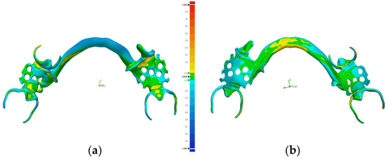 Fit Accuracy of Cobalt–Chromium and Polyether Ether Ketone Prosthetic ...