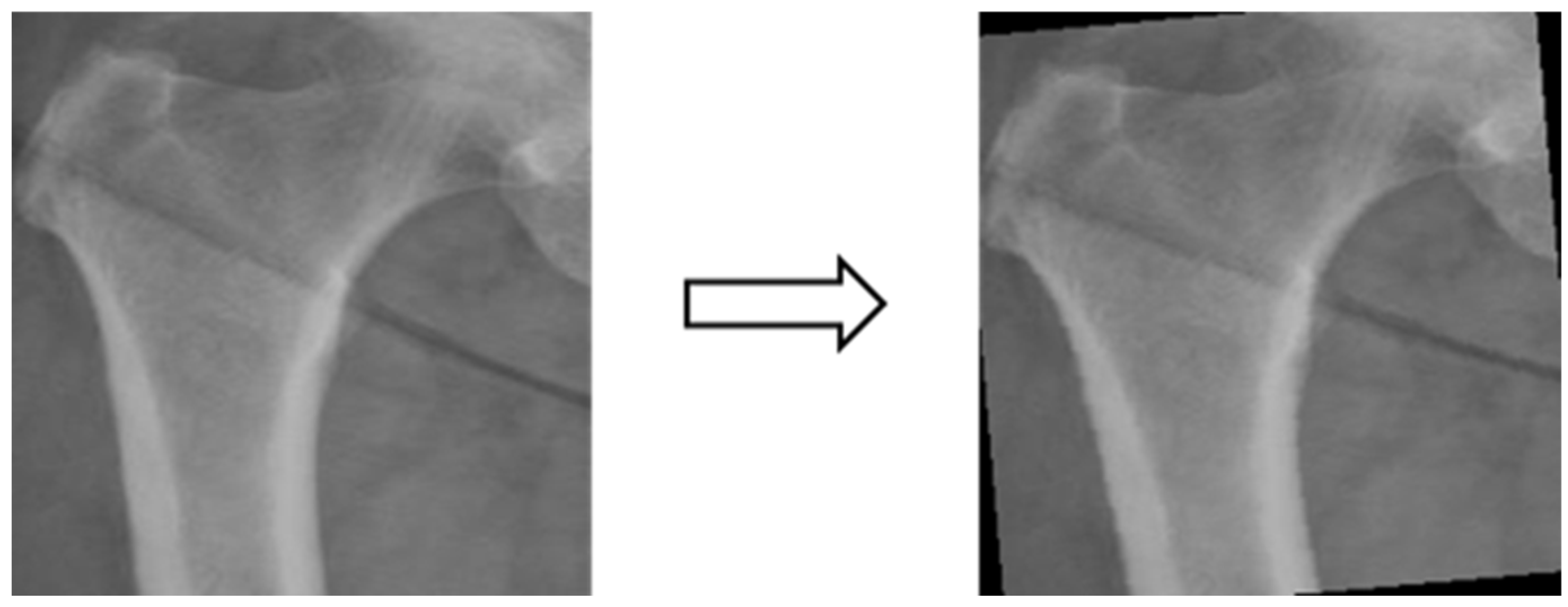 Applied Sciences | Free Full-Text | Deep Learning-Based Hip X-ray Image ...