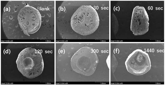 Development of Polymer-Cored Akaganeite Adsorbent for Phosphate Adsorption