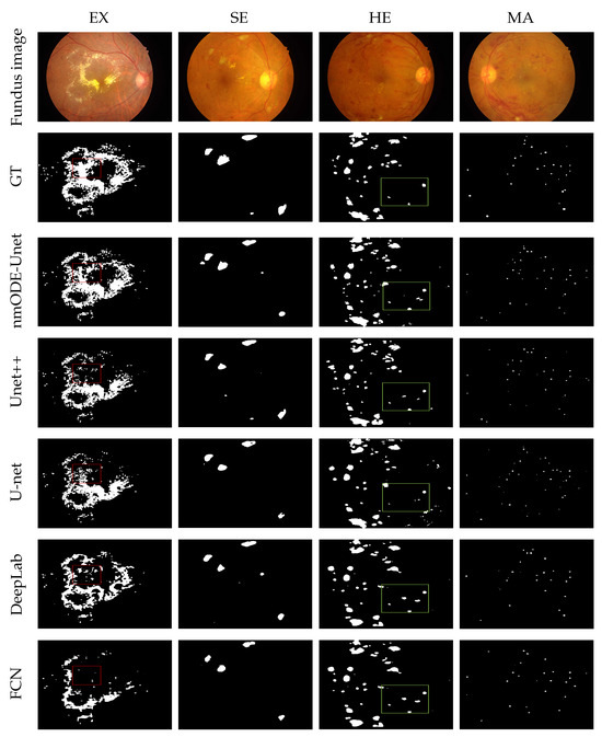 nmODE-Unet: A Novel Network for Semantic Segmentation of Medical Images