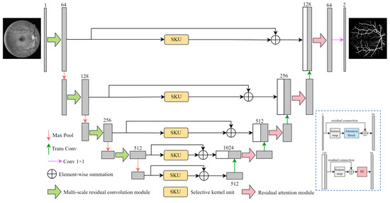 Research on Retinal Vessel Segmentation Algorithm Based on a Modified U-Shaped Network