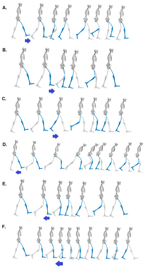 Influence of Perturbation’s Type and Location on Treadmill Gait Regularity