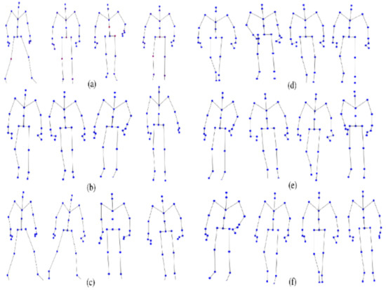 Pathological Gait Classification Using Early and Late Fusion of Foot ...
