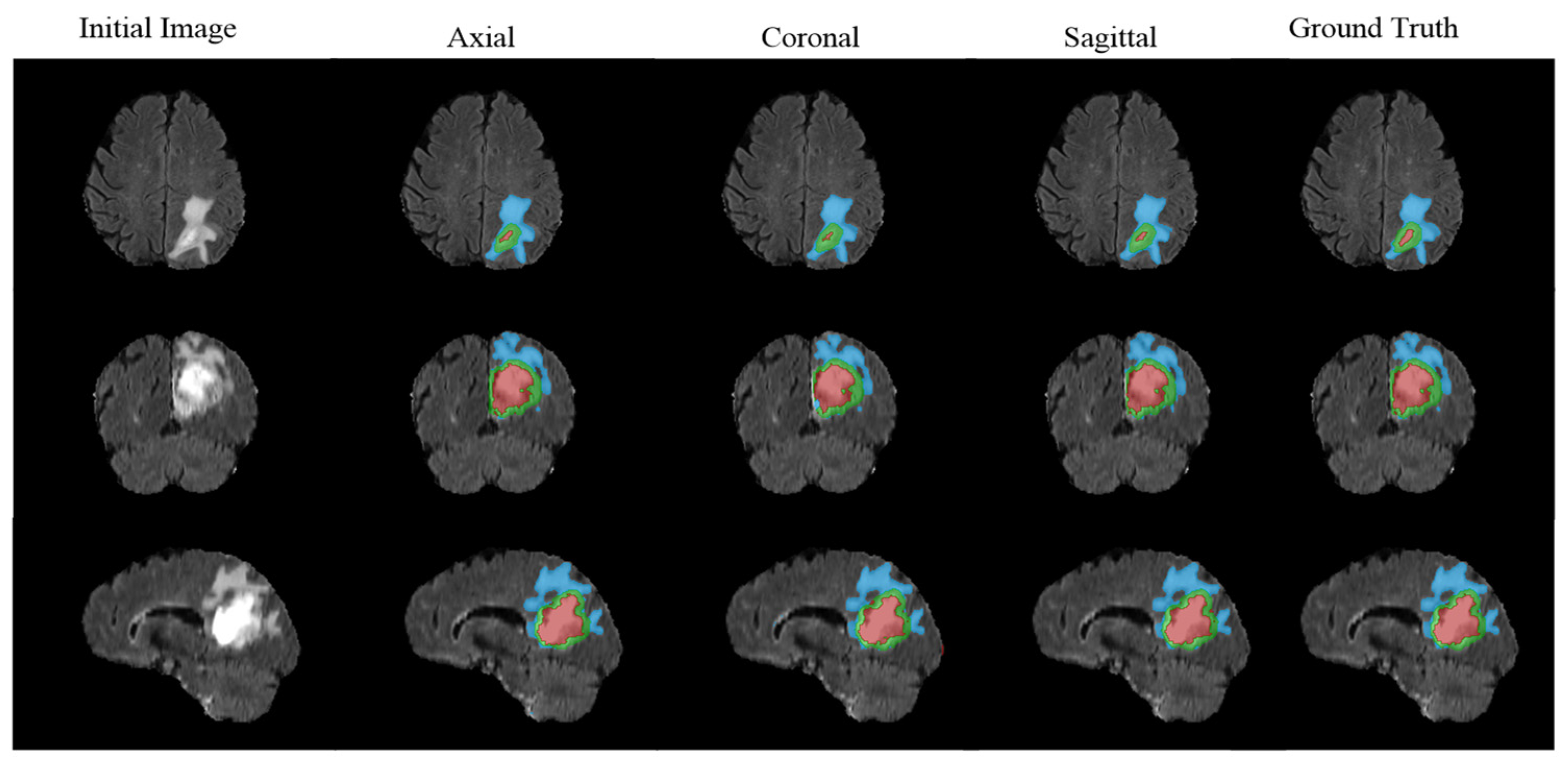 Applied Sciences | Free Full-Text | Biomedical Image Segmentation Using Denoising Diffusion ...