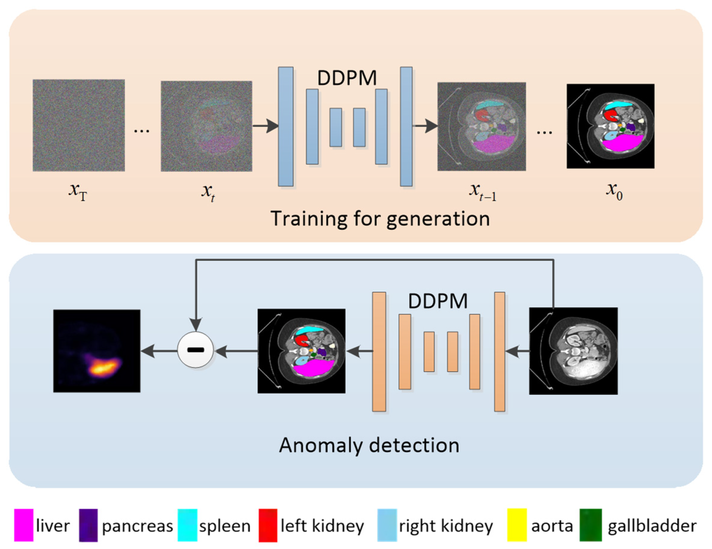 Applied Sciences | Free Full-Text | Biomedical Image Segmentation Using Denoising Diffusion ...