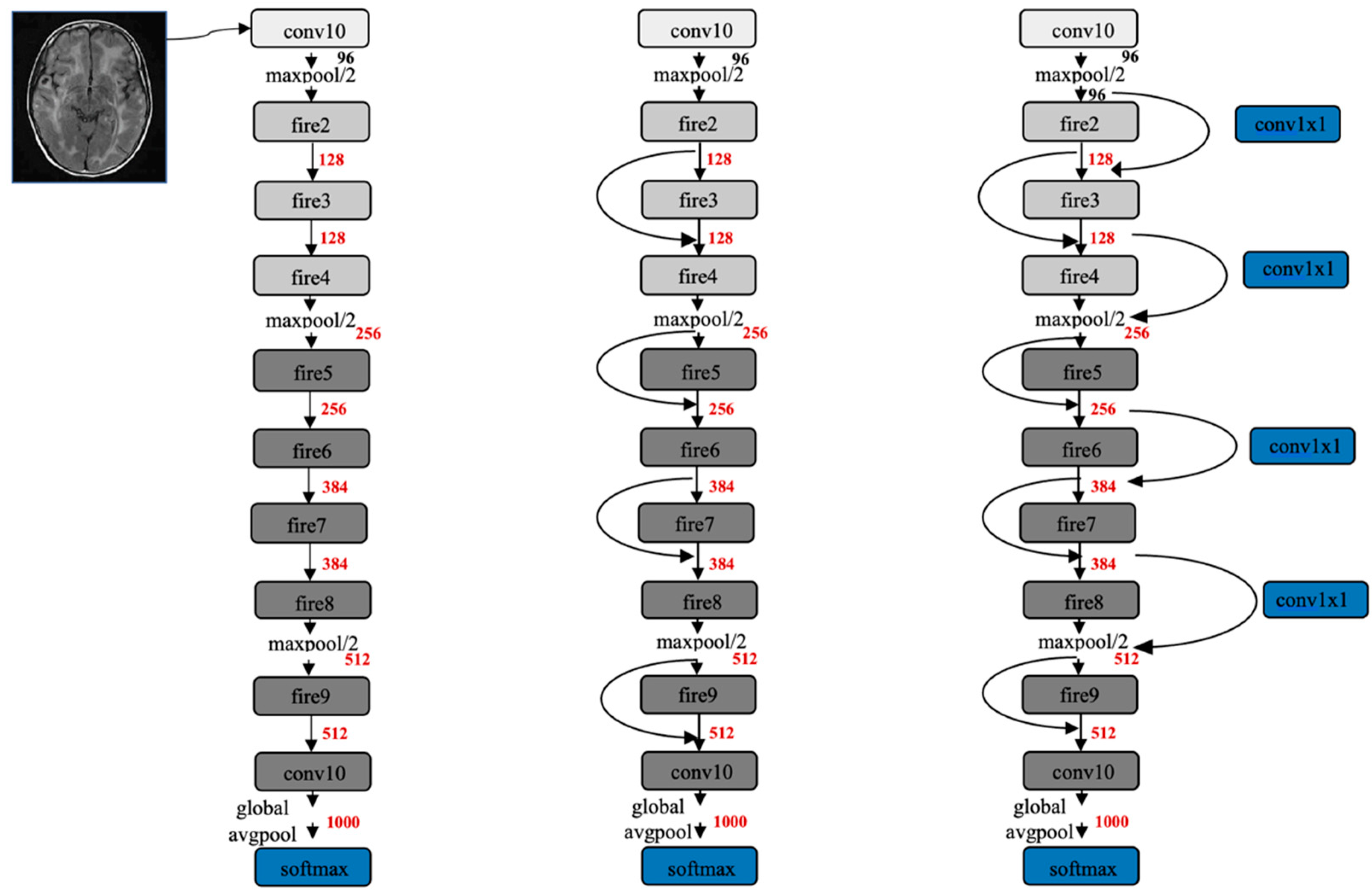 Applied Sciences | Free Full-Text | Brain Tumor Detection with Deep ...