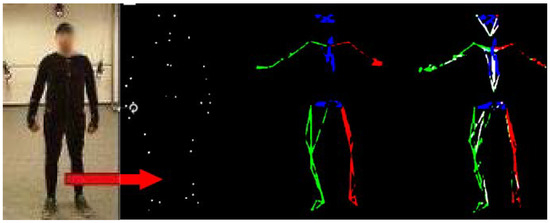 A Biomechanical Evaluation of the Upper Limb Kinematic Parameters of ...