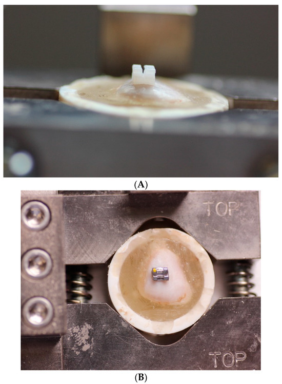 A Comparative Assessment of the Bonding Characteristics of Three ...
