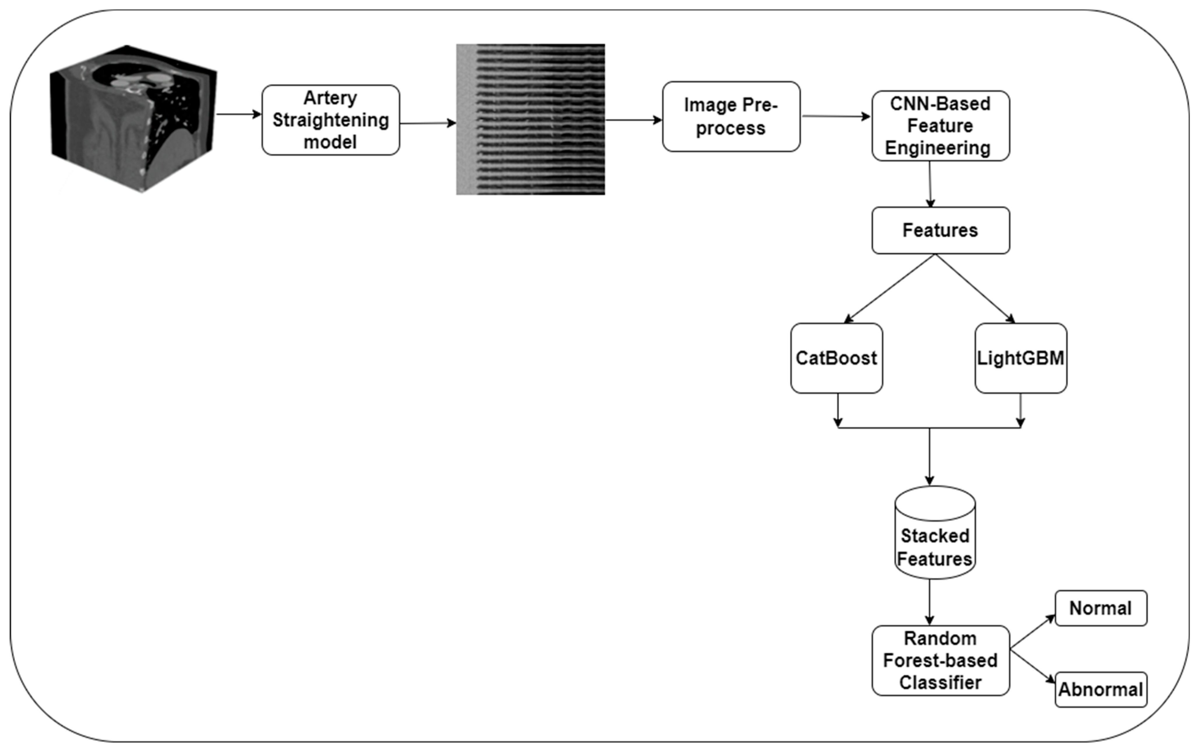 Ensemble Learning-Based Coronary Artery Disease Detection Using ...