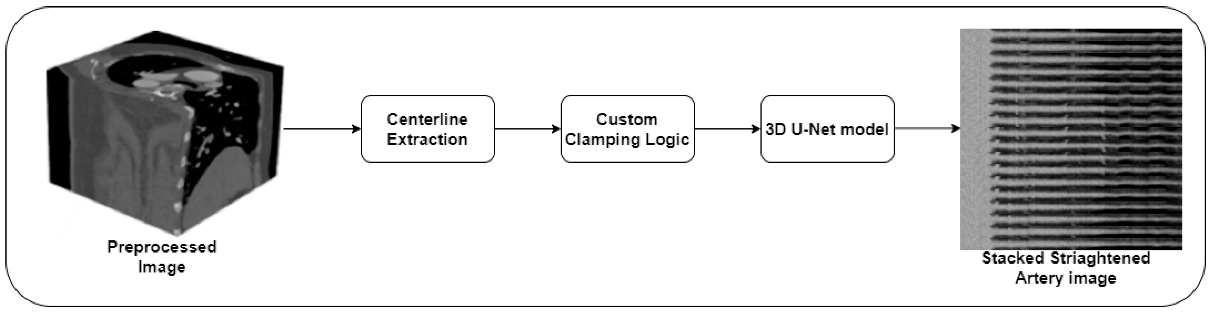Ensemble Learning-Based Coronary Artery Disease Detection Using ...