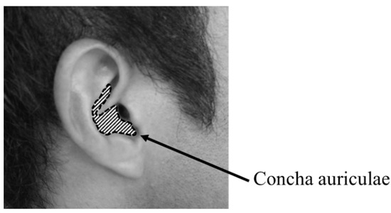 Measurement of the Mechanical Impedance of Ear Cartilage and ...