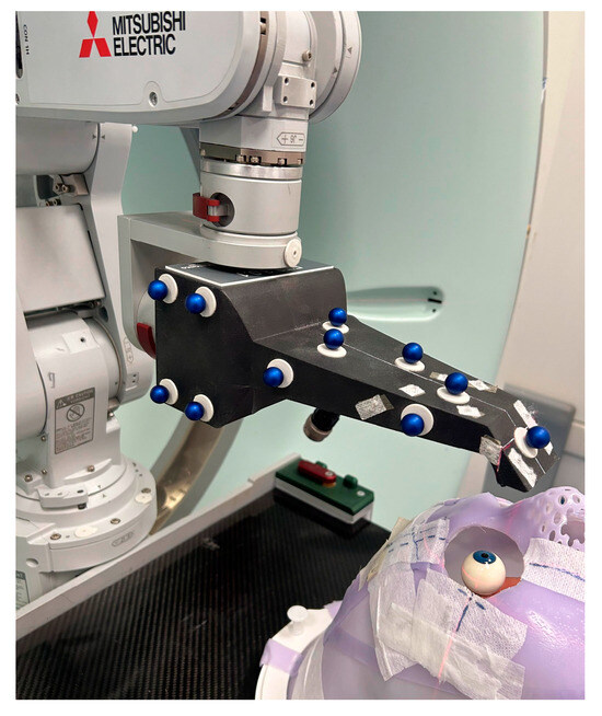 Setup Optimization in Ocular Proton Therapy at the National Centre for ...