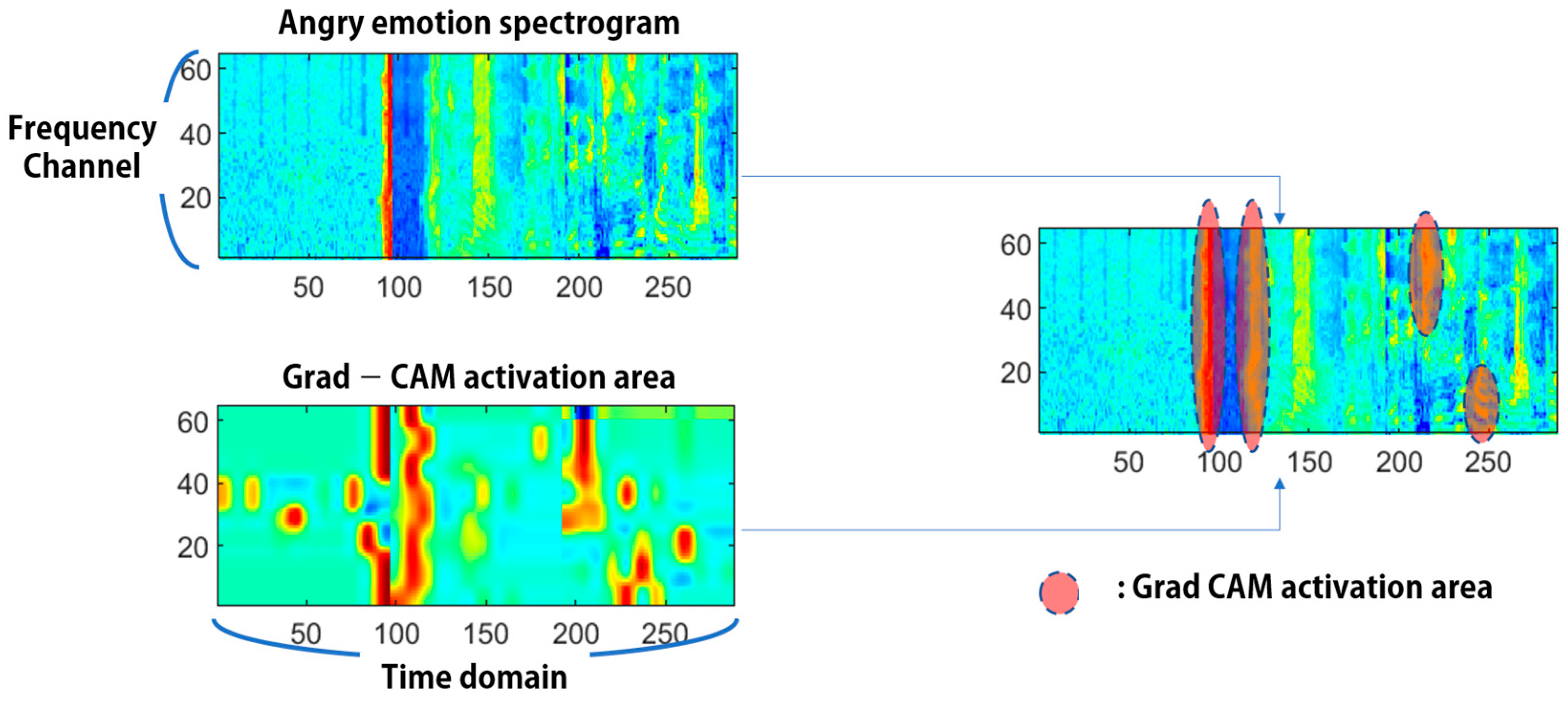 Speech Emotion Recognition Using Deep Learning Transfer Models and ...
