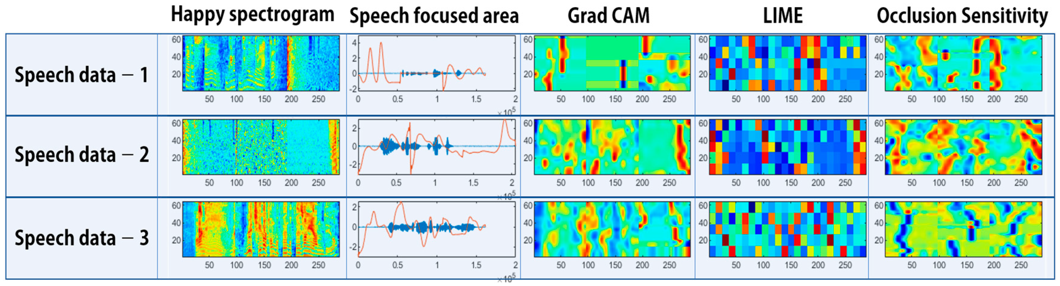 Applied Sciences | Free Full-Text | Speech Emotion Recognition Using Deep Learning Transfer ...