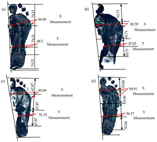 Biomechanical Evaluation of Plantar Pressure Distribution towards a ...