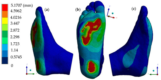 Biomechanical Evaluation of Plantar Pressure Distribution towards a ...