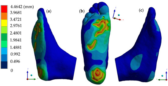 Biomechanical Evaluation of Plantar Pressure Distribution towards a ...