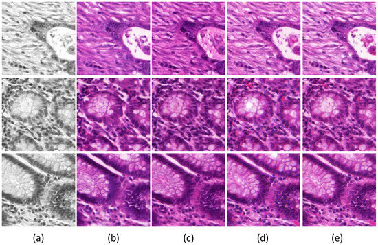 A Virtual Staining Method Based on Self-Supervised GAN for Fourier ...