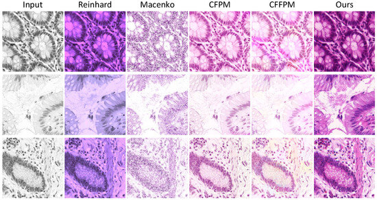 A Virtual Staining Method Based on Self-Supervised GAN for Fourier ...