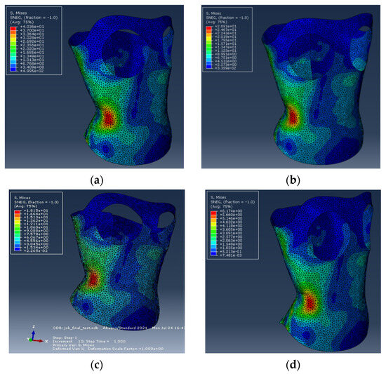 Numerical Modeling and Nonlinear Finite Element Analysis of Conventional and 3D-Printed Spinal ...