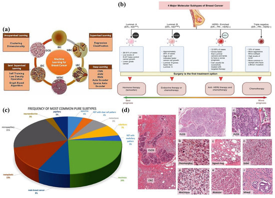 Exploring the Potential of Nanoparticles in the Treatment of Breast ...