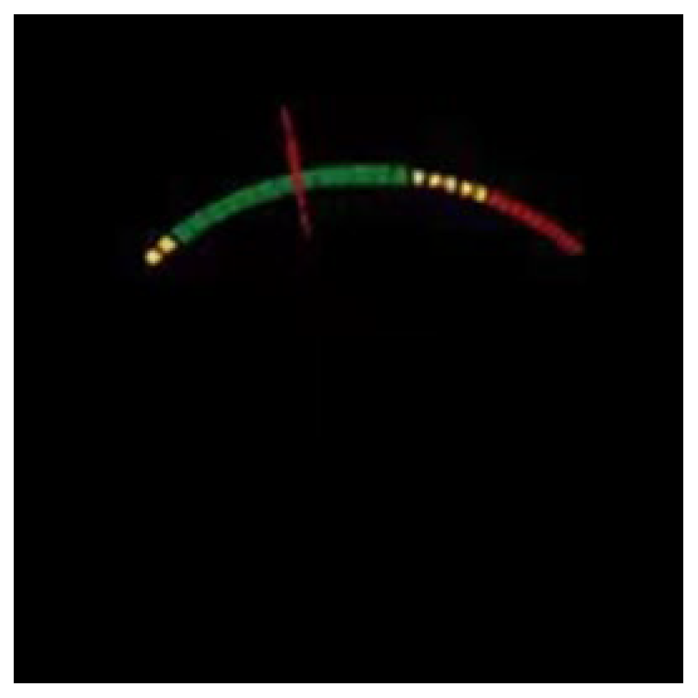 Research on the Recognition Method of Dial Scales for Arrester Pointer ...
