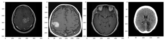 Automated Brain Tumor Identification in Biomedical Radiology Images: A ...