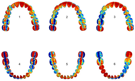 Applied Sciences | Free Full-Text | Computerized Optical Impression ...