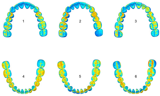 Applied Sciences | Free Full-Text | Computerized Optical Impression ...