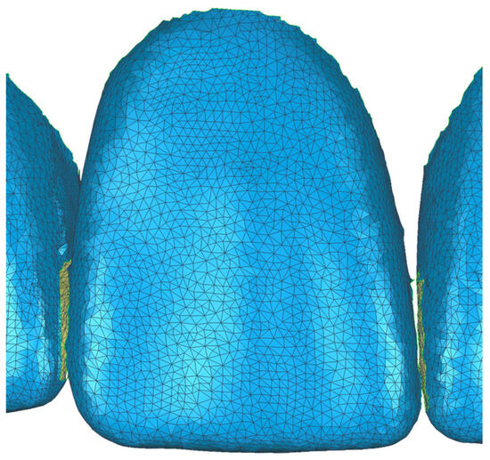 Applied Sciences | Free Full-Text | Computerized Optical Impression ...