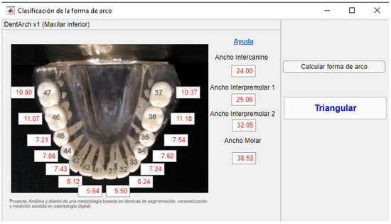 DentalArch: AI-Based Arch Shape Detection in Orthodontics