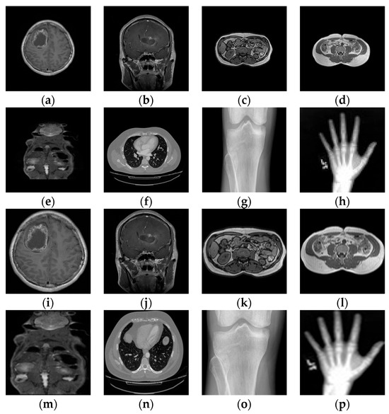 Data Hiding and Authentication Scheme for Medical Images Using Double POB