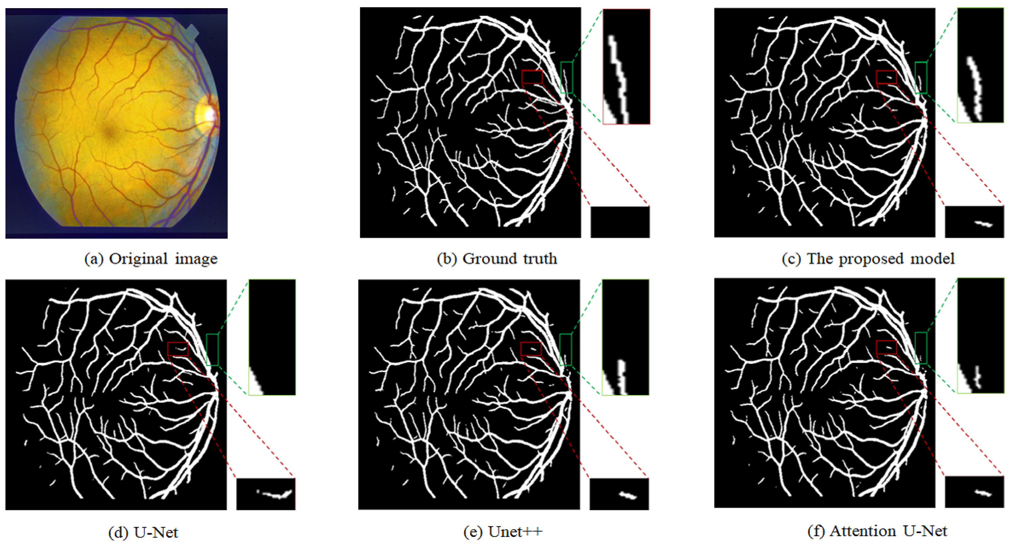 A Multi-Scale Attention Fusion Network for Retinal Vessel Segmentation
