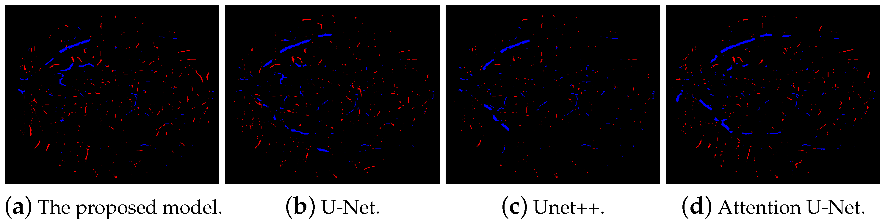 A Multi-Scale Attention Fusion Network for Retinal Vessel Segmentation
