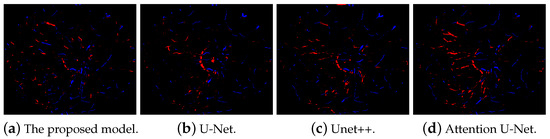 A Multi-Scale Attention Fusion Network for Retinal Vessel Segmentation