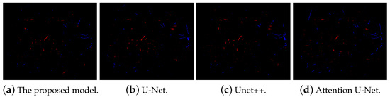 A Multi-Scale Attention Fusion Network for Retinal Vessel Segmentation