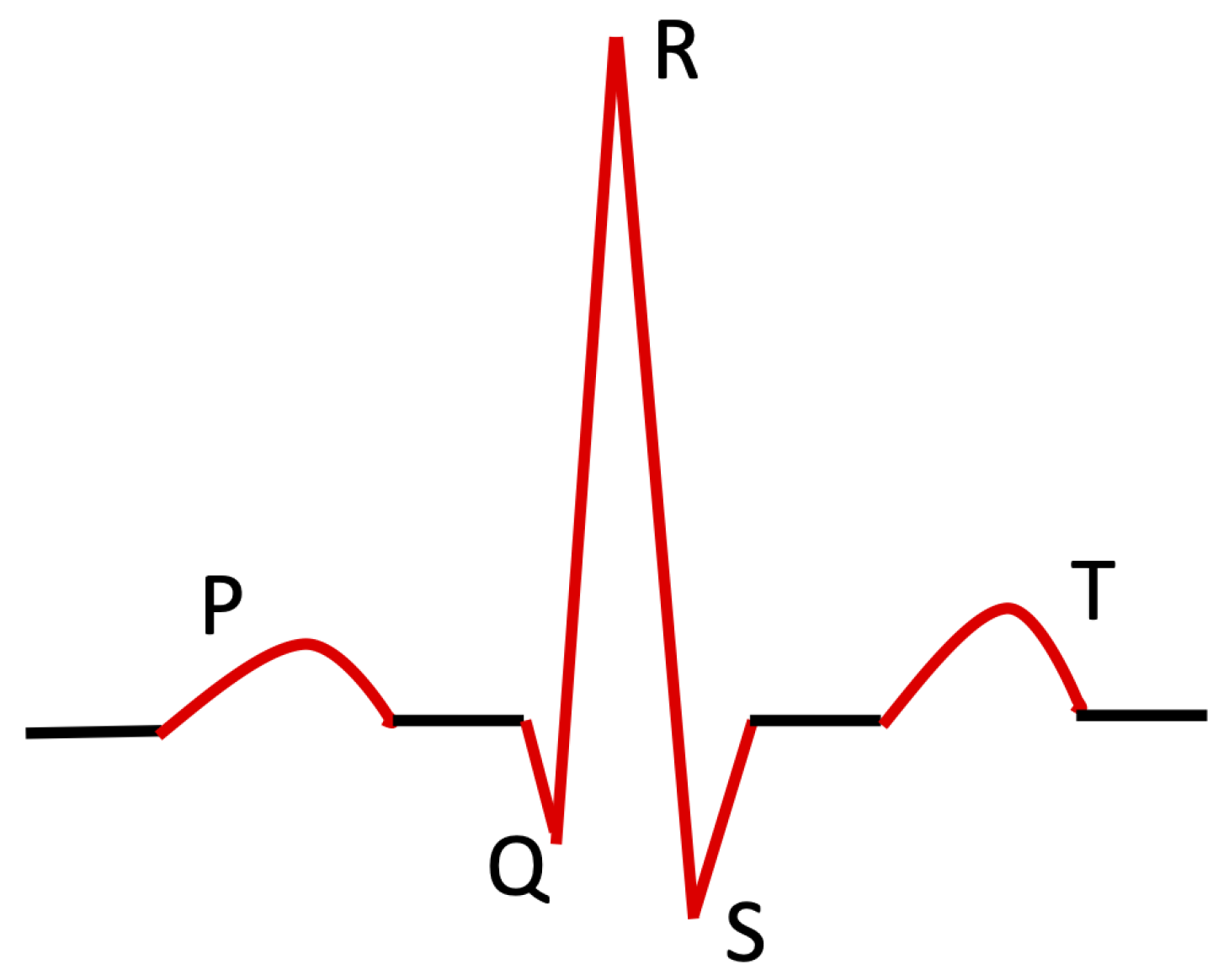 Enhancing Heartbeat Classification through Cascading Next Generation ...