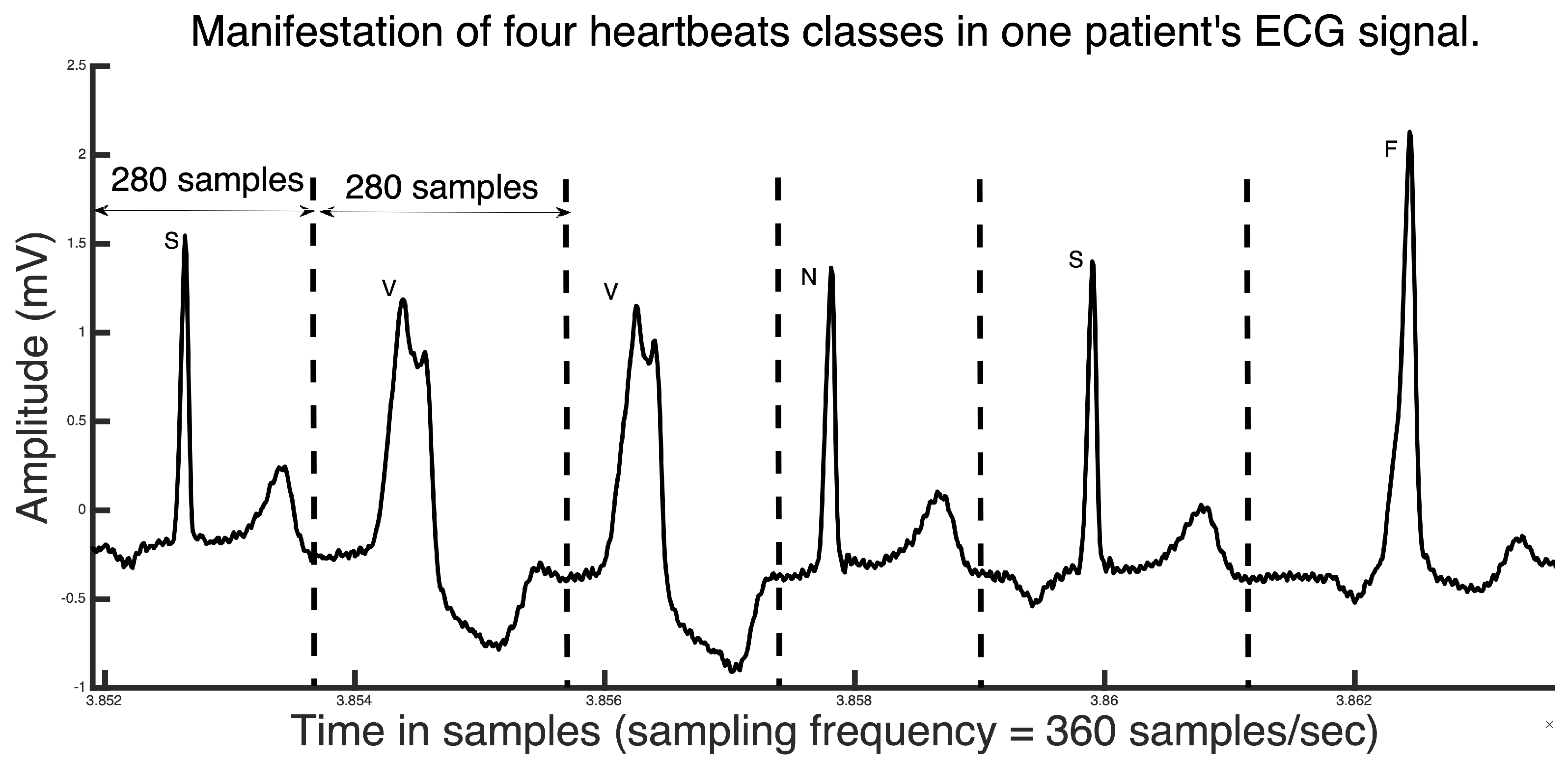 Enhancing Heartbeat Classification through Cascading Next Generation and Conventional Reservoir ...
