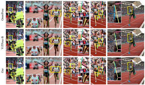 High-Resolution Multi-Scale Feature Fusion Network for Running Posture ...