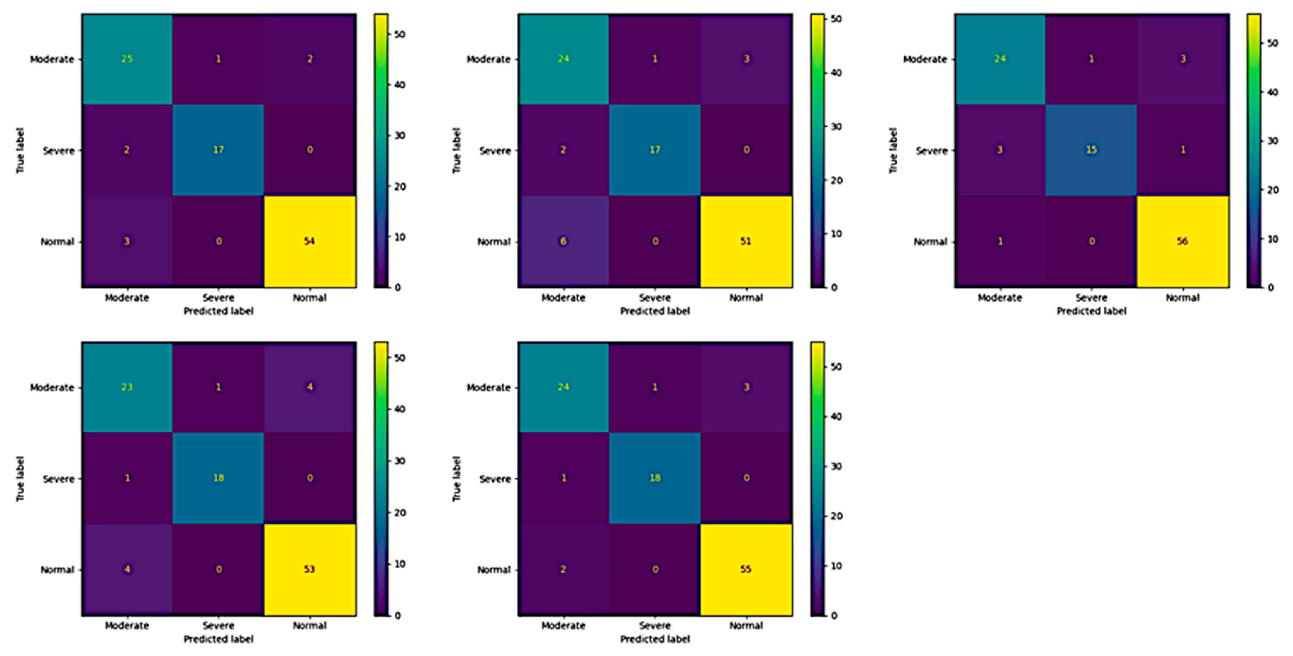 Transfer Learning-Based Classification of Maxillary Sinus Using ...