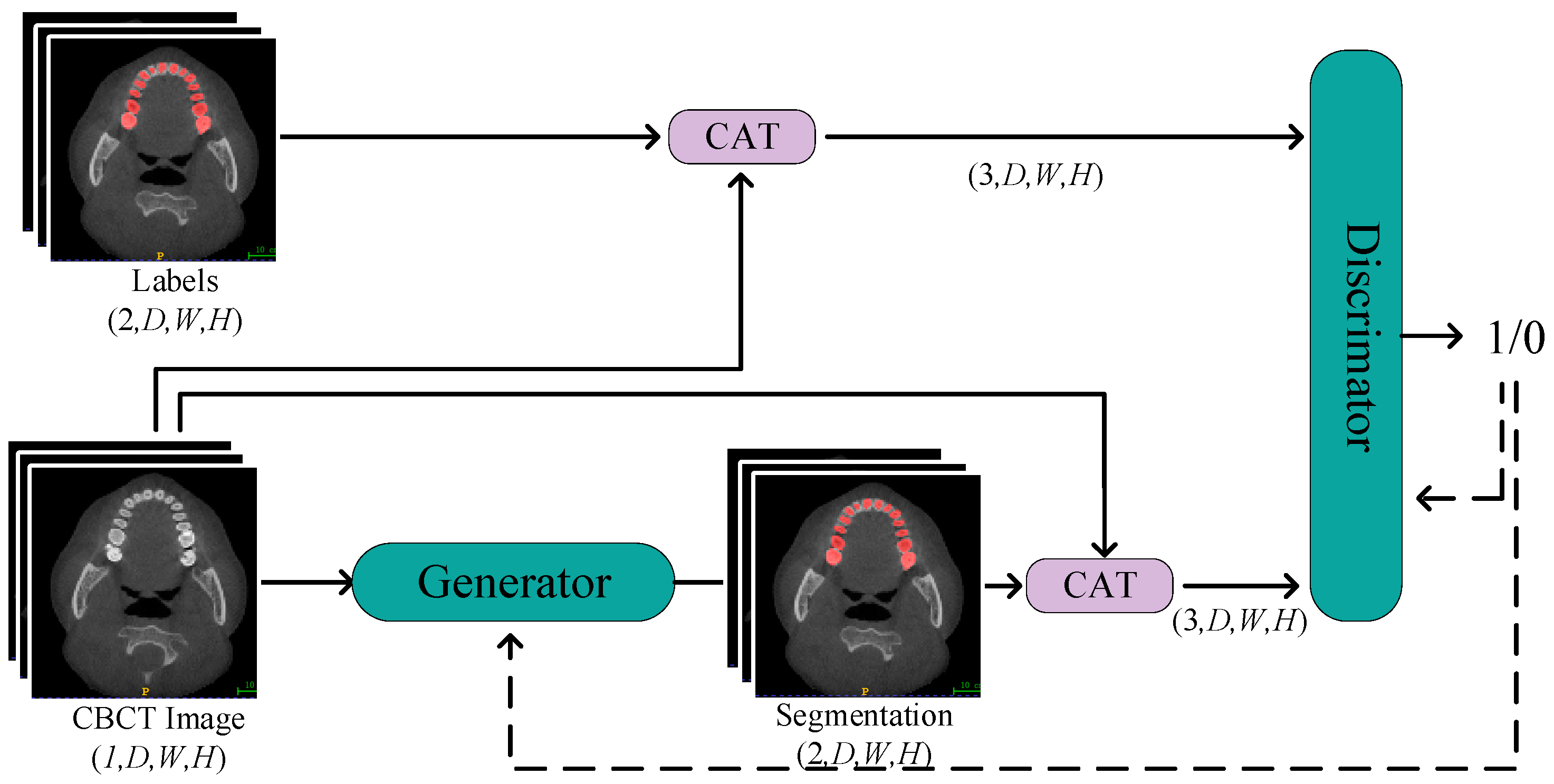 PPA-SAM: Plug-and-Play Adversarial Segment Anything Model for 3D Tooth Segmentation