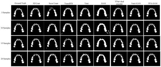 PPA-SAM: Plug-and-Play Adversarial Segment Anything Model for 3D Tooth Segmentation