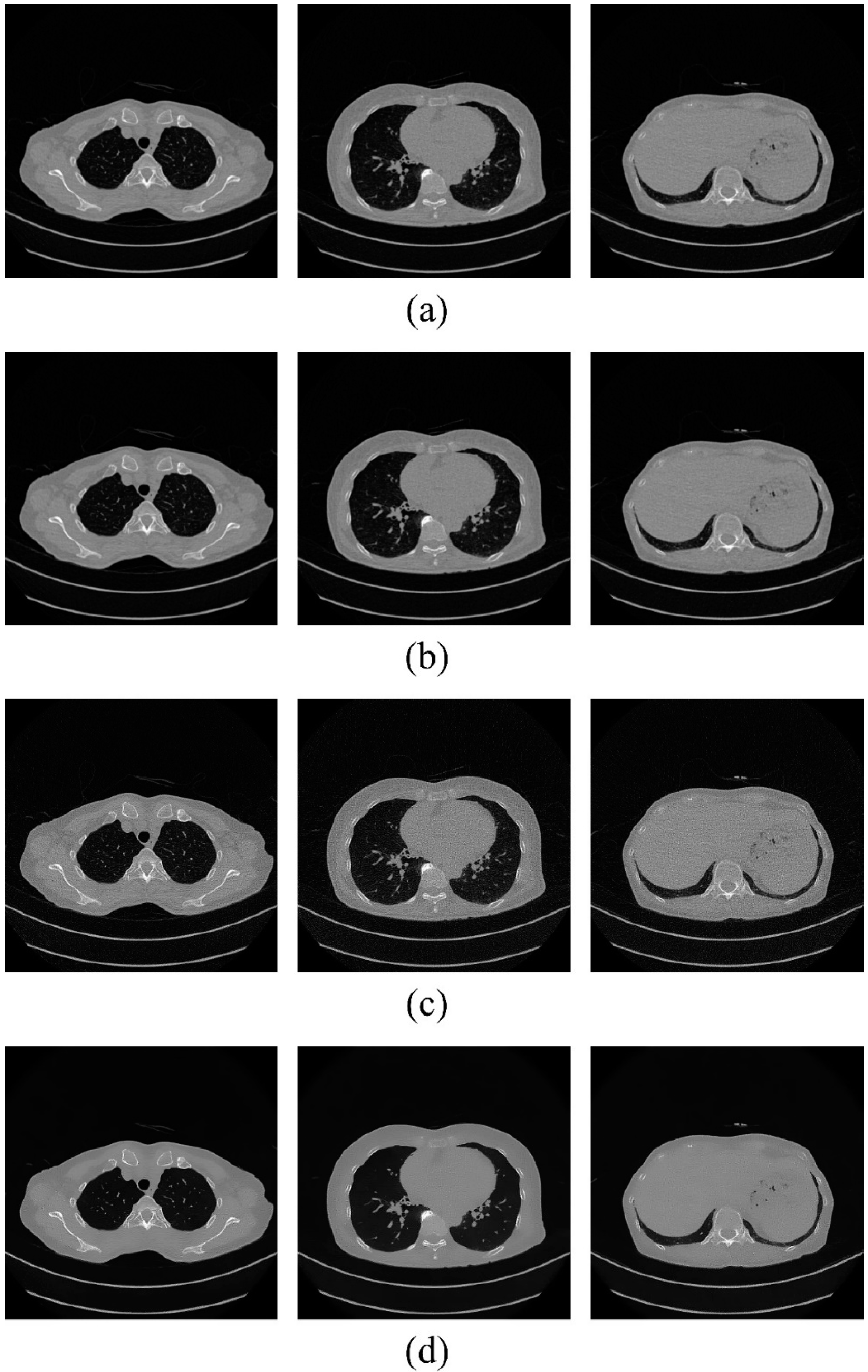 Usefulness Evaluation for Nonlocal Means Algorithm in Low-Dose Computed Tomography with Various ...